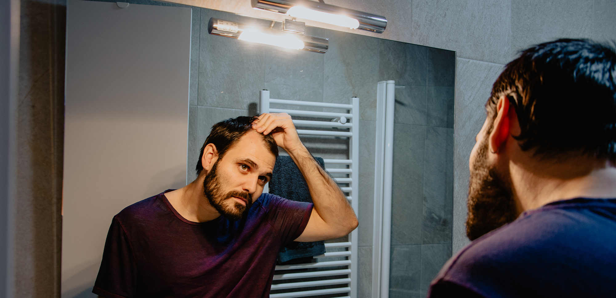 Hair Transplant Recovery | What To Expect